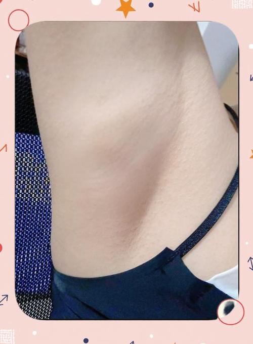 女性腋窝发痒要警惕图标