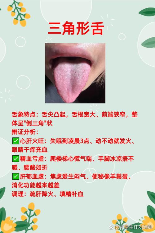 舌苔正常颜色的图片