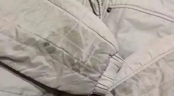 羽绒服上的黄斑怎么去除小窍门截图