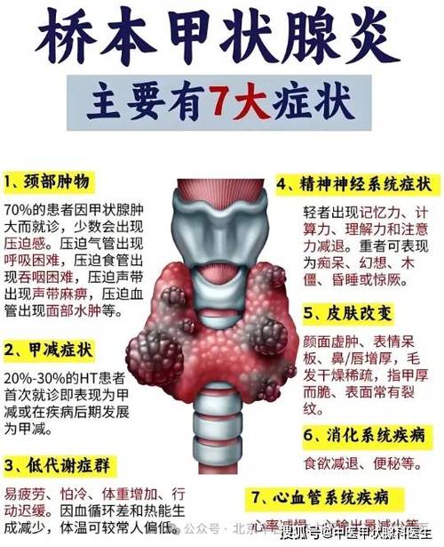 桥本氏甲状腺能治好吗截图