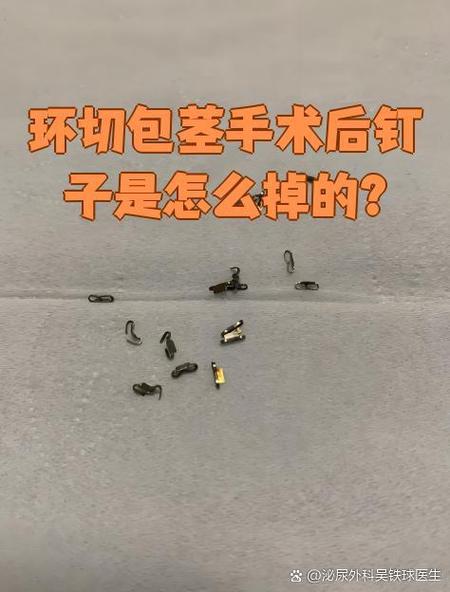 钉进去的钉子怎么弄出来图标