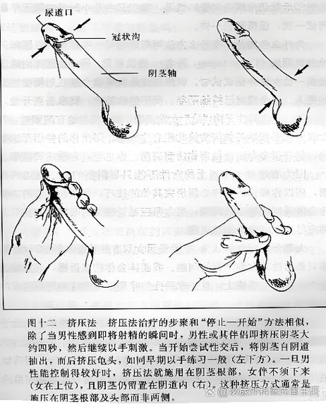 男人早射精怎么治疗好截图