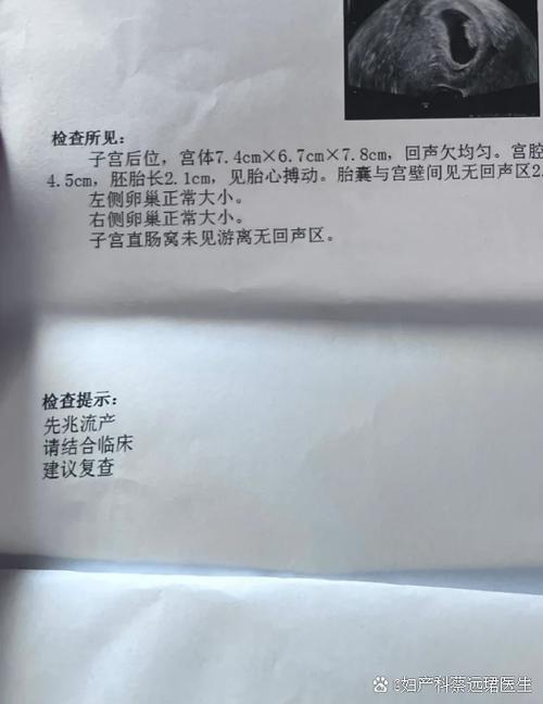 怀孕6周只看到暗区什么原因图标