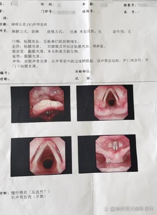 声带受损声音嘶哑怎么办图标