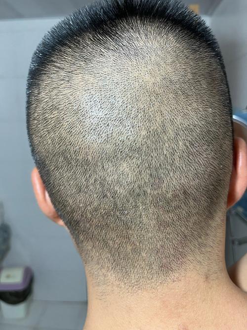 光头强工作日志图标