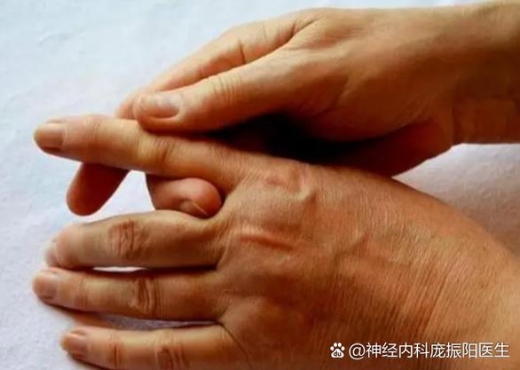 手指头总自己跳图标