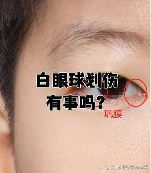 眼睛伤怎么看出是新伤还是旧伤截图