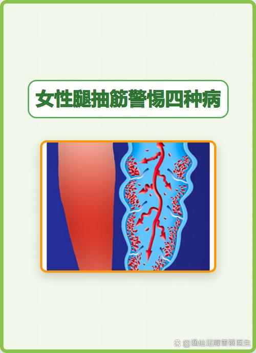 抽筋是什么意思图标