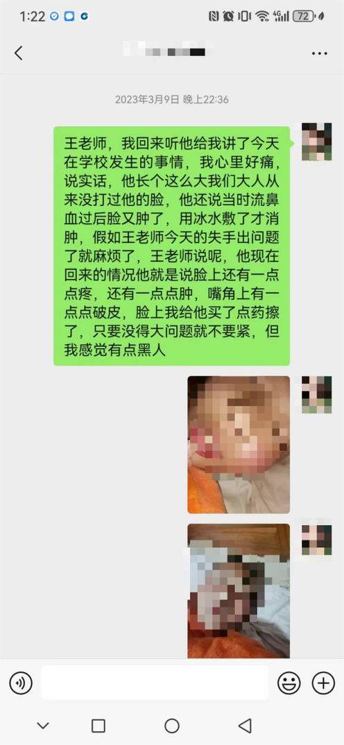 湖北恩施5岁女童遭教师体罚截图