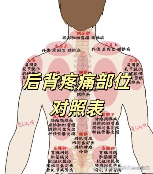 右后背疼痛对照表图标