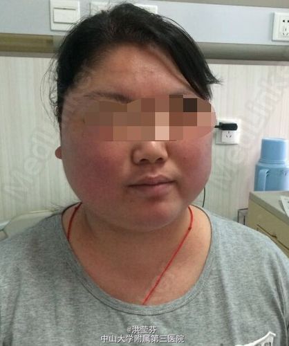 苹果手机怎么看有几个面容图标