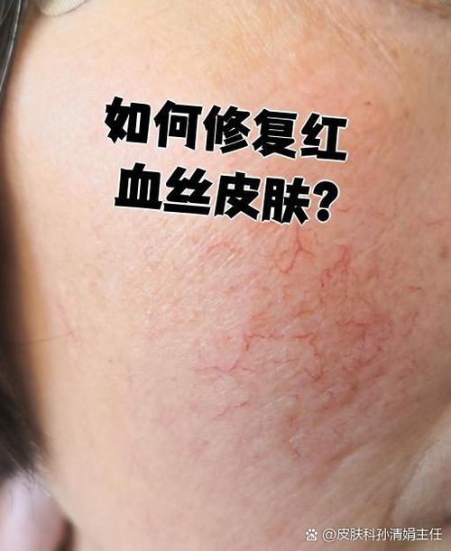 水初语修复红血丝效果怎么样截图
