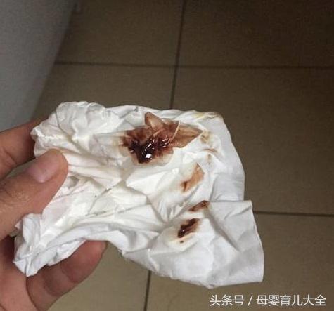 非经期内裤上有棕褐色分泌物截图