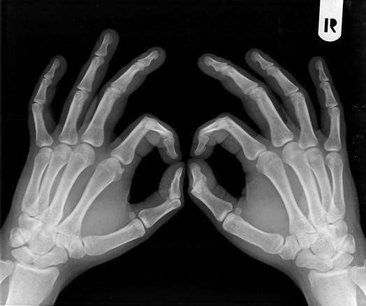 x-ray对人体的危害图标