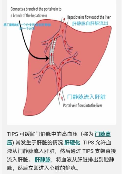 tips全称图标