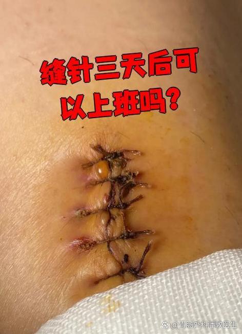 缝针3针图片图标