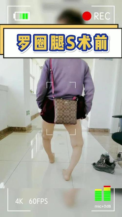 腿上的肉走路会转截图