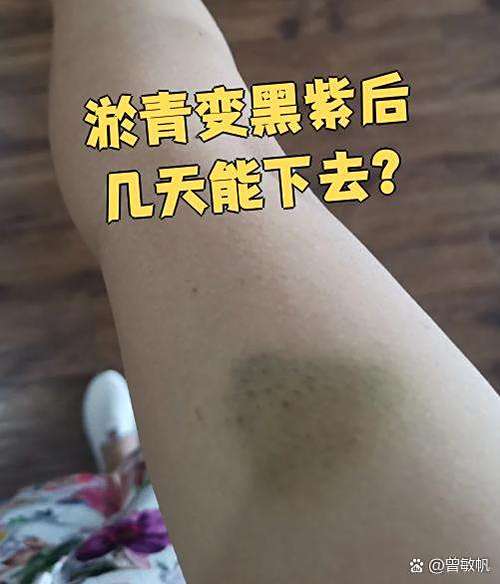 皮带打女生光屁股多少下会变紫青截图