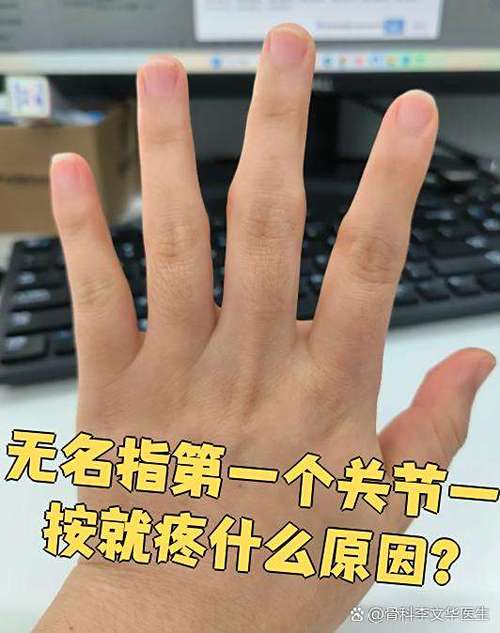 手指关节一捏就疼图标