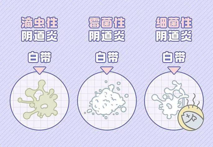 有很多白色分泌物是怎么回事图标