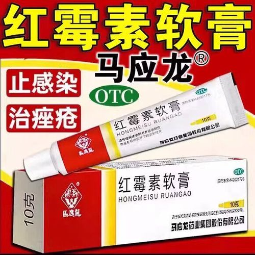 被烫了擦红霉素软膏吗图标