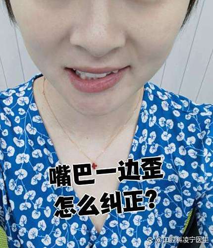 嘴歪了怎么矫正图标