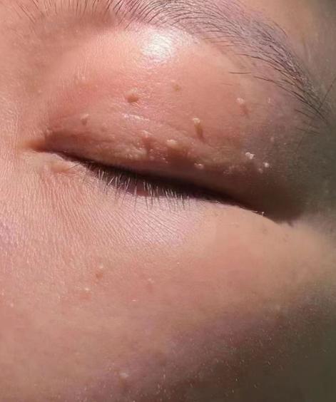 脸上的肉跳动怎么回事图标