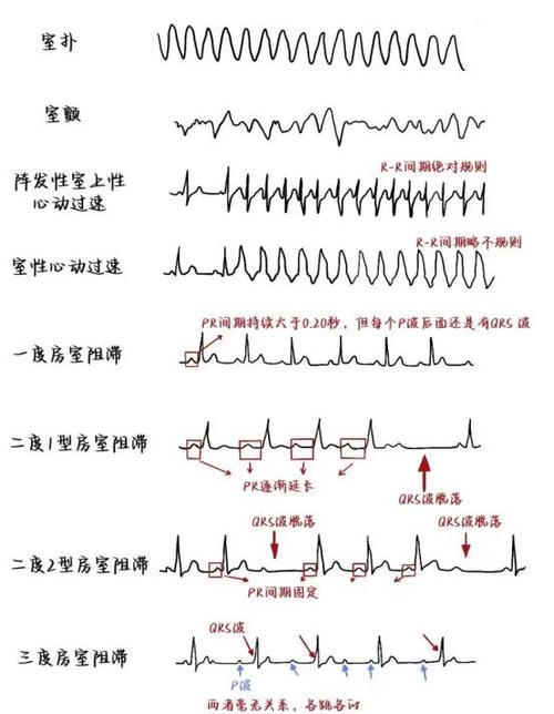 lovelive怎么快速得心截图