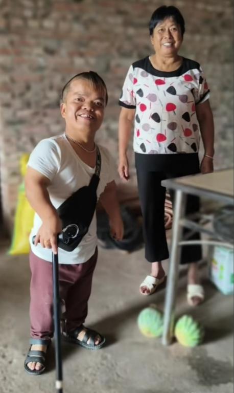 侏儒是什么样子的