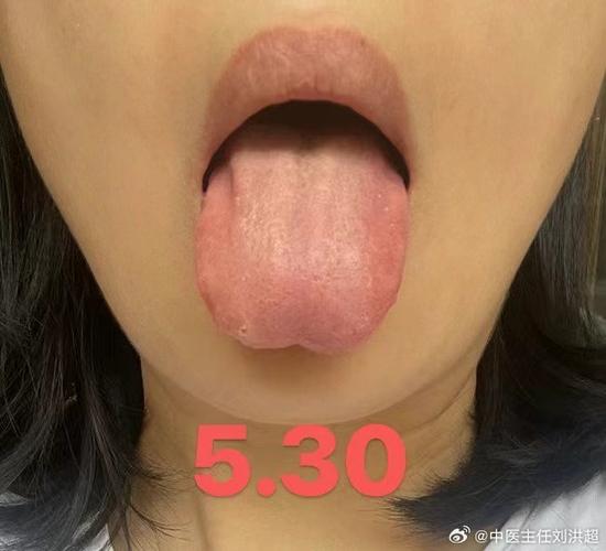 男生舌头短女生少乐趣截图