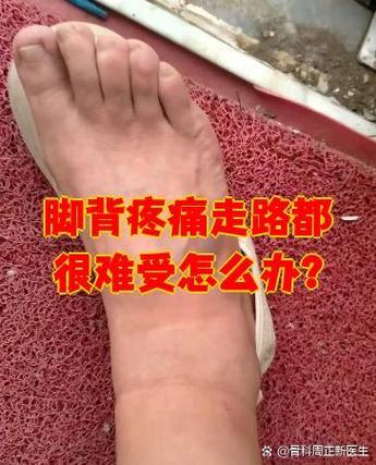 走路脚酸累严重咋回事图标