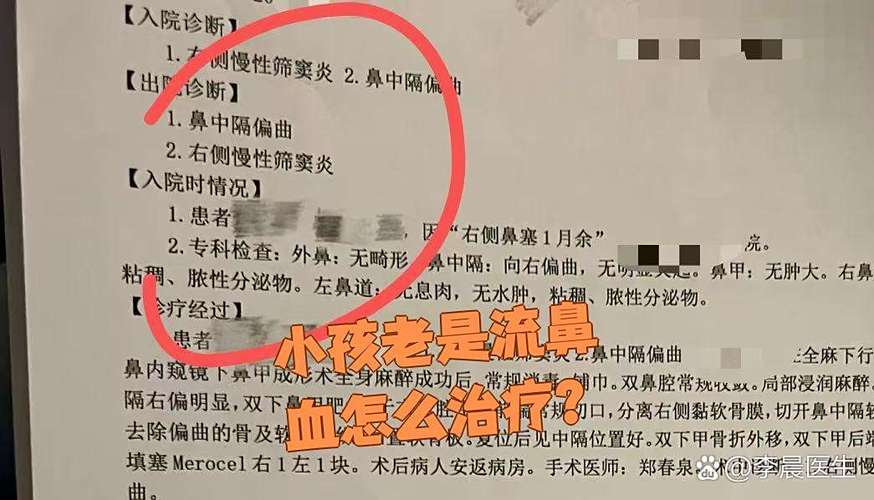 流鼻血调皮说说截图