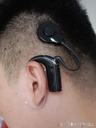 耳鸣的人戴助听器有效果吗?图标