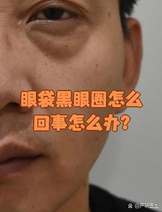 仓眼里有黑怎么办截图