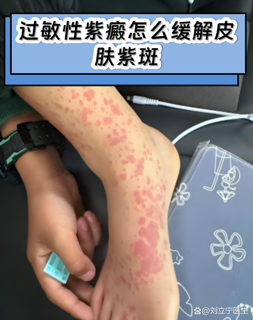 小米手机屏幕出现紫色斑块图标