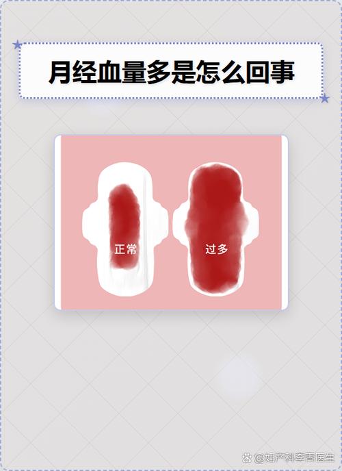 月经流量多少为正常截图