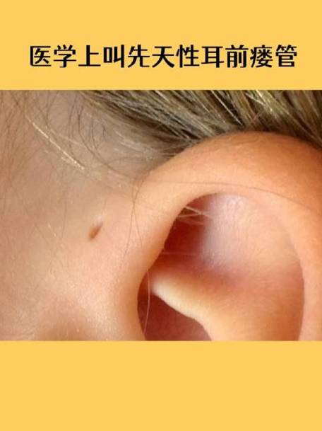 蓝牙耳机充电仓丢了能定位吗截图