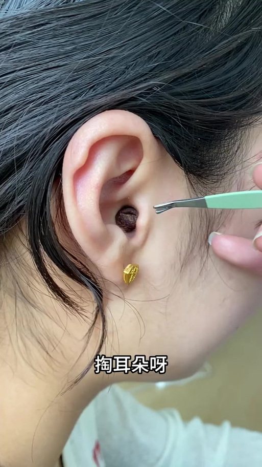 蓝牙耳机进耳屎了怎么办图标