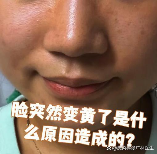 脸变黄了是身体哪里出问题了