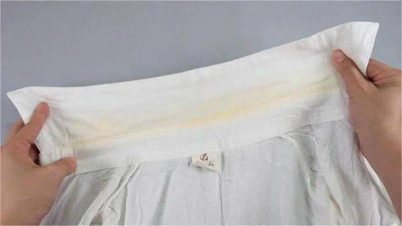 白色衣服领子发黄怎么洗白图标