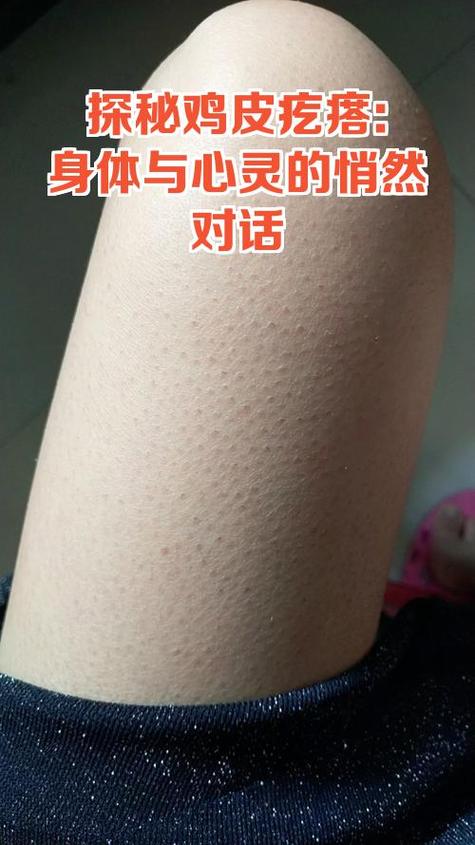皮肉里有硬疙瘩图标