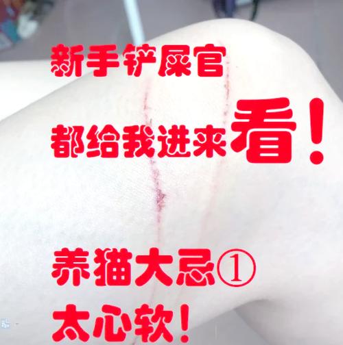 让猫咪挠破了怎么办