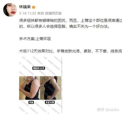 吸脂肚子10斤多少费用图标