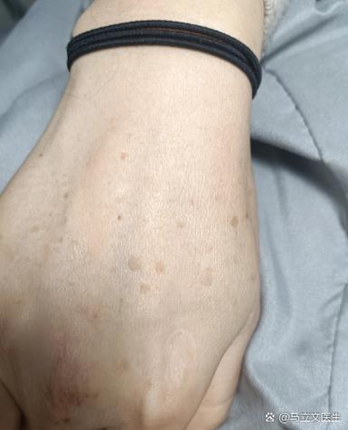 老化的特征有哪些图标
