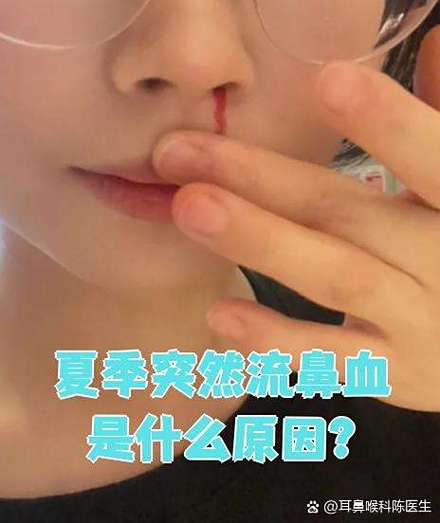 突然流鼻血的原因有哪几种截图