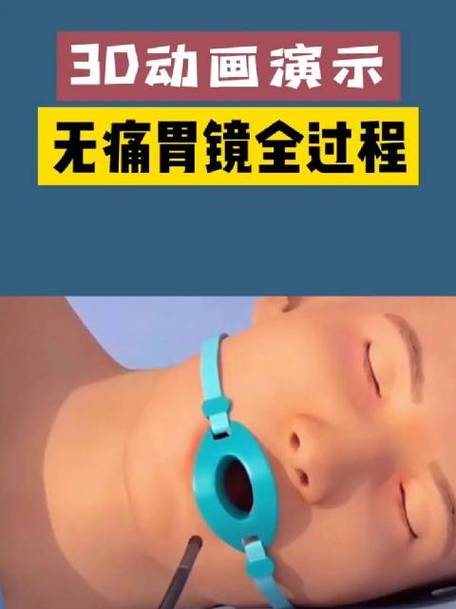 胃镜的视频真正的视频