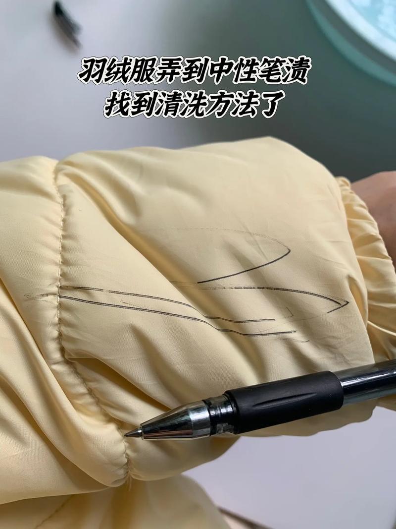 羽绒服的笔渍怎么去除图标