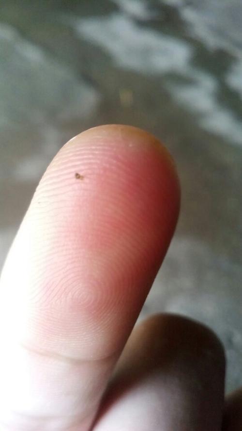小点点虫子,不仔细看几乎看不见
