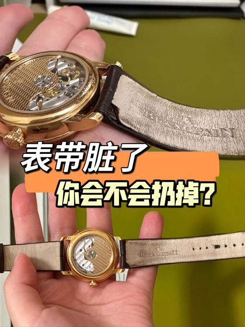 手表白色表带变黄了怎么办截图