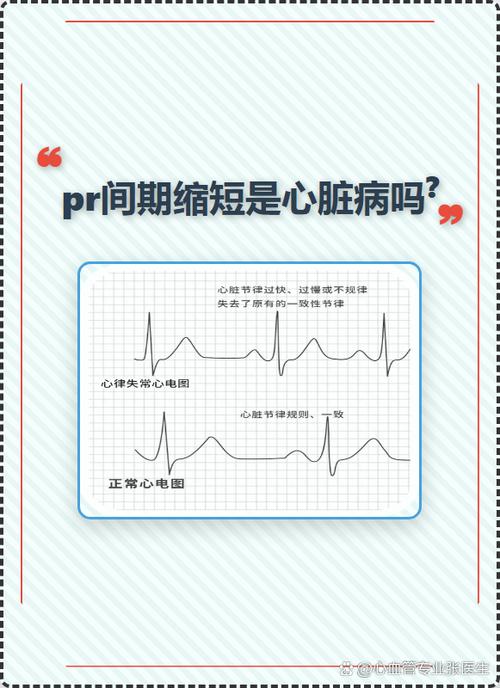 pr间期正常值范围是多少图标